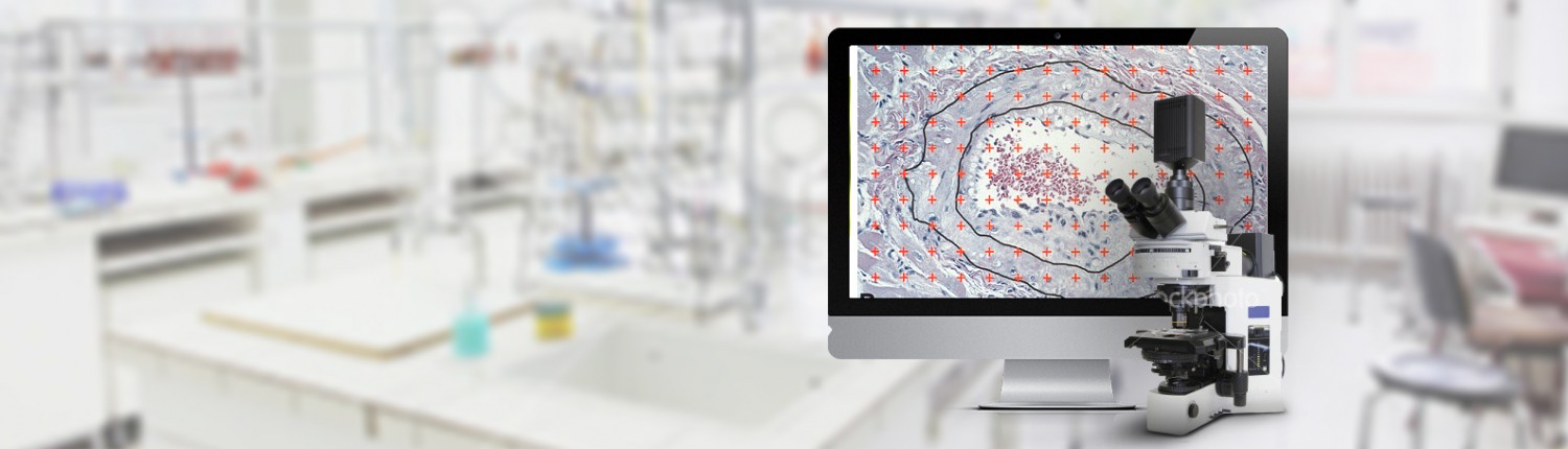 Stereology Systems - SRC Biosciences | Tampa Florida