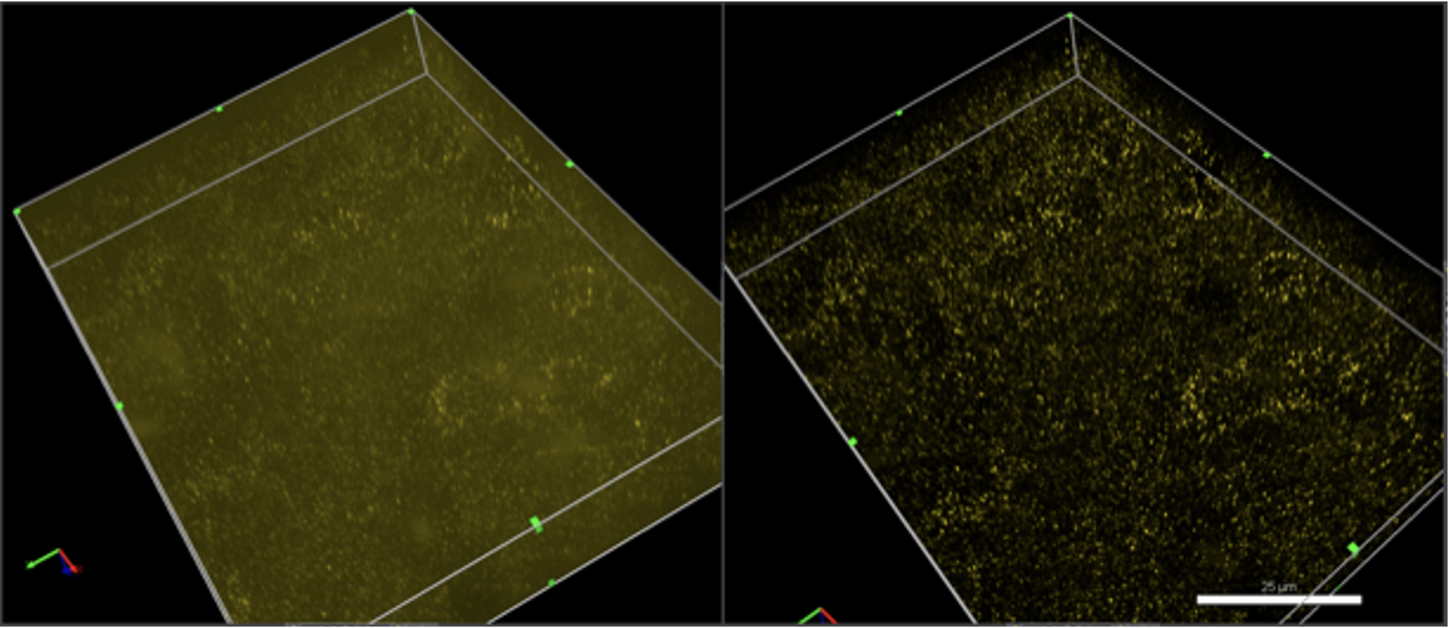Fluorescence Microscopy Greatly Benefits from Stereology