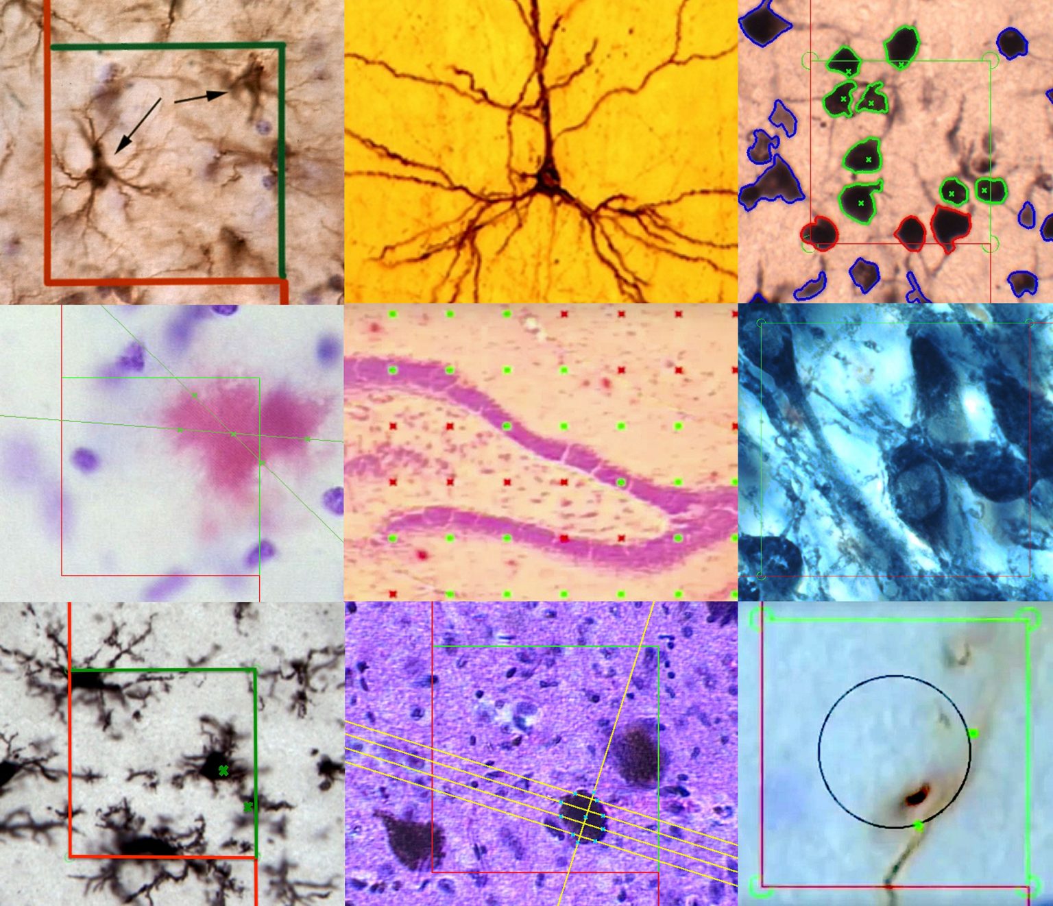 Stereologer Software - SRC Biosciences | Tampa FL