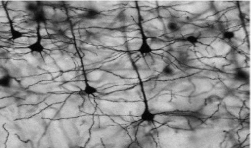 Dendrite Analysis is Improved with Stereology